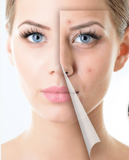 İsotrexin Jel Neye İyi Gelir? | Kombin Kadın