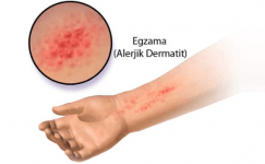 Pruzon Krem Ne İşe Yarar, Fiyat 2025? | Kombin Kadın